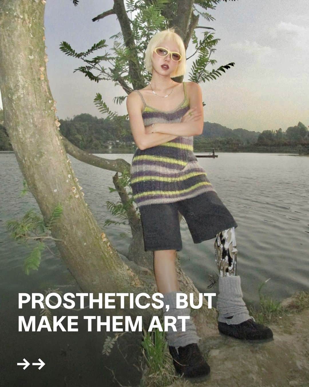 VICEさんのインスタグラム写真 - (VICEInstagram)「Xiaoyang’s protheses are a work of ...